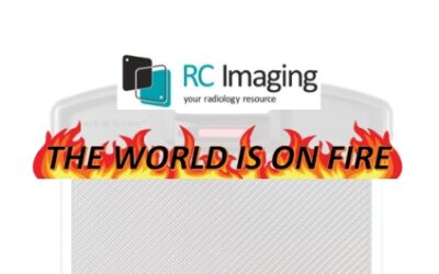 Radiology Equipment, Radiography Accessories, X-Ray Supplies - Rochester, Irondequoit, Greece ...